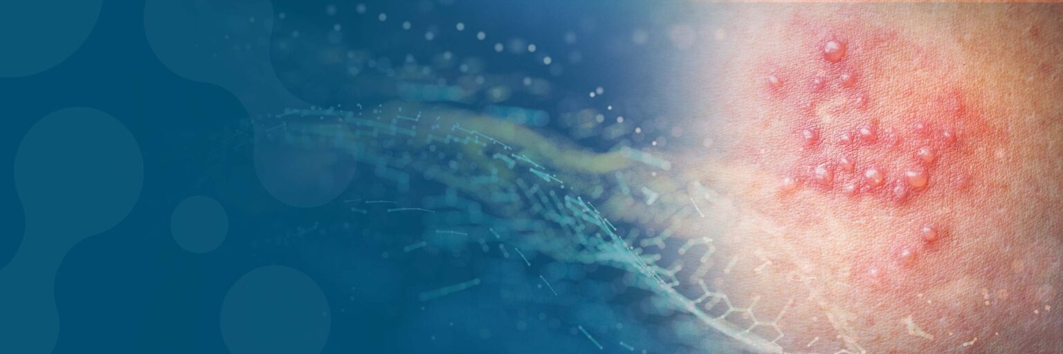 Shingles Vaccine Clinical Research Studies | IMA Research
